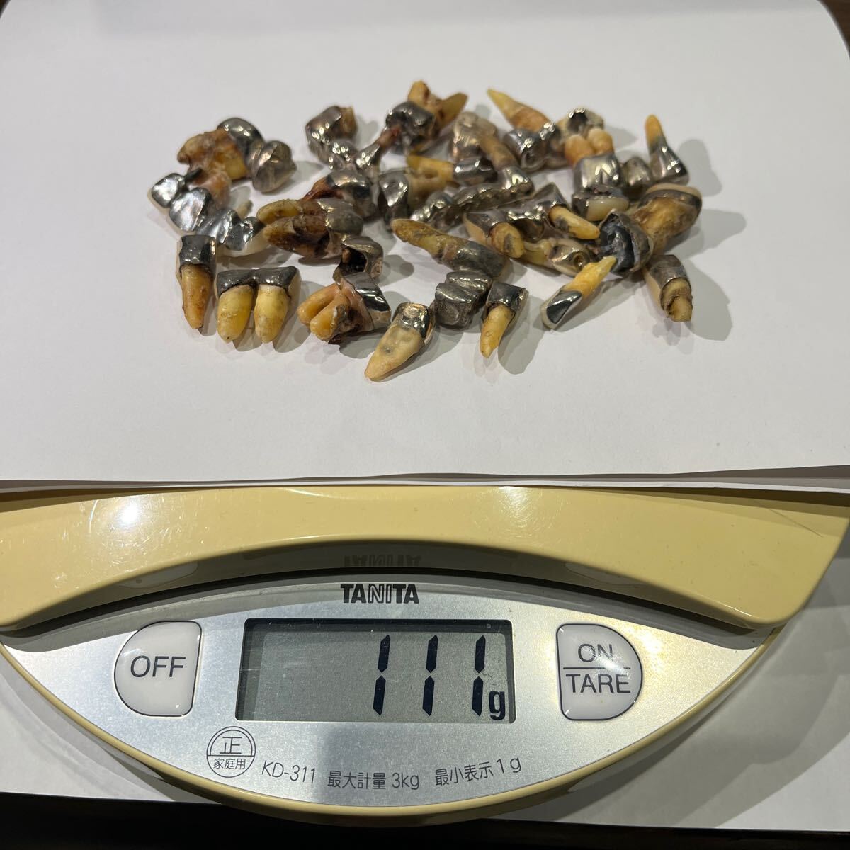 Yahoo!オークション - 撤去冠 除去冠 111g