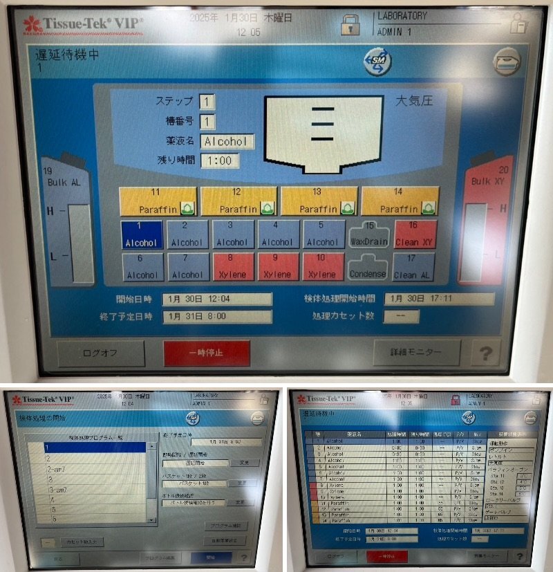 サクラ精機 ティシュー テック VIP6 検体前処理装置 密閉式自動固定包埋装置 Tissue Tek VIP 6-J0 医療機器 現状品(その他)｜売買されたオークション情報、yahooの ...