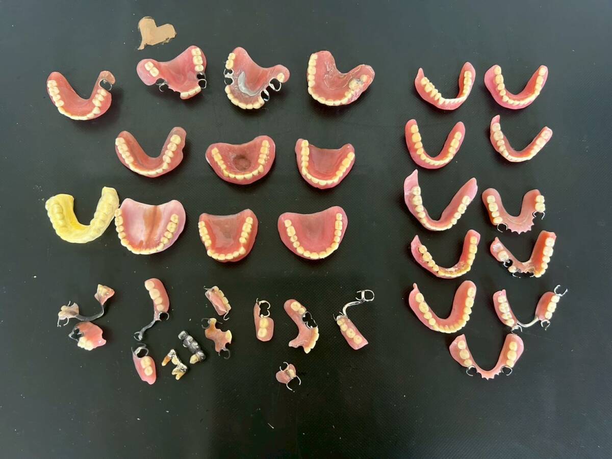 Yahoo!オークション - 6-3 入れ歯 まとめ 約471g 入歯 総入れ歯 部分入...