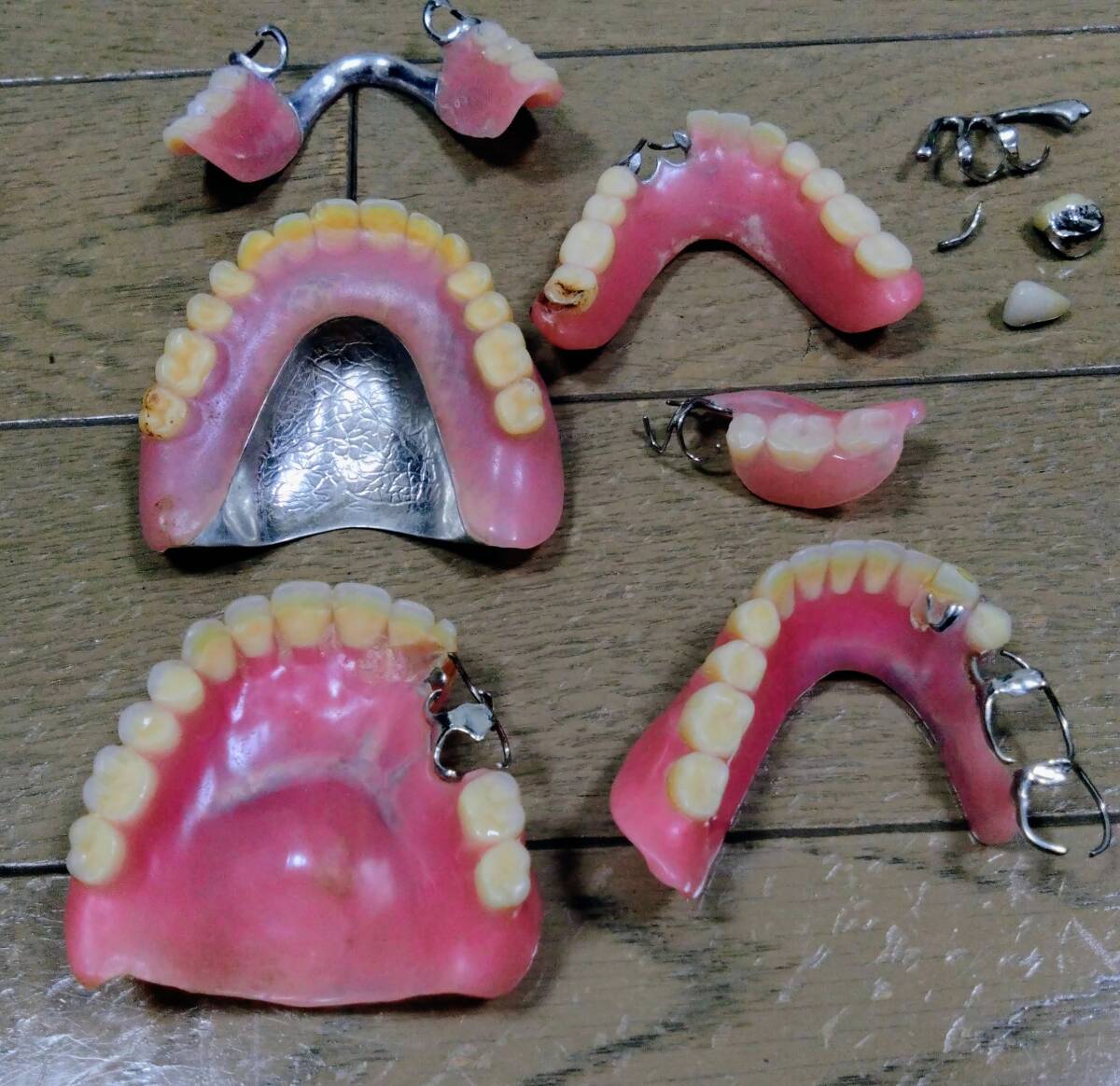 Yahoo!オークション - 銀歯 入れ歯 入歯 歯科金属 ジャンク 95g