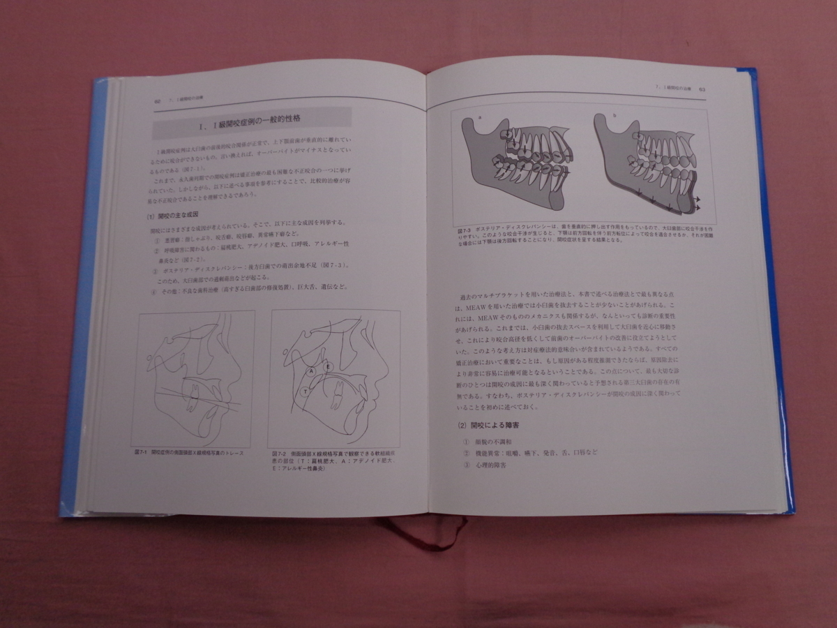 Yahoo!オークション - 『 MEAWを用いた矯正治療 - MEAWテクニックの実...