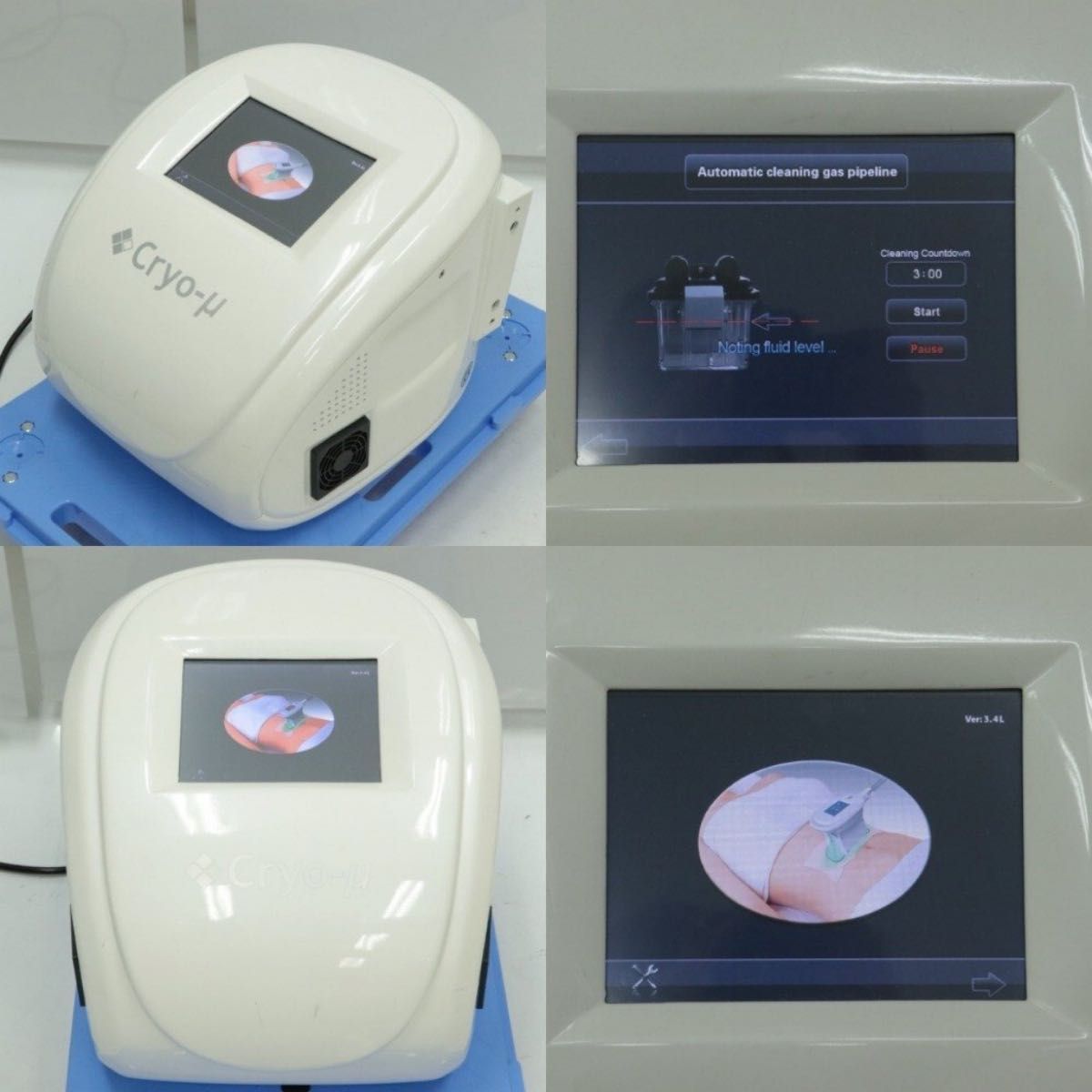 waarmラボラトリー クライオミュー Cryo-μ CRYO6S-A6B 脂肪冷却 waarmラボラトリー クライオミュー Cryo-μ CRYO6S-A6B 脂肪冷却