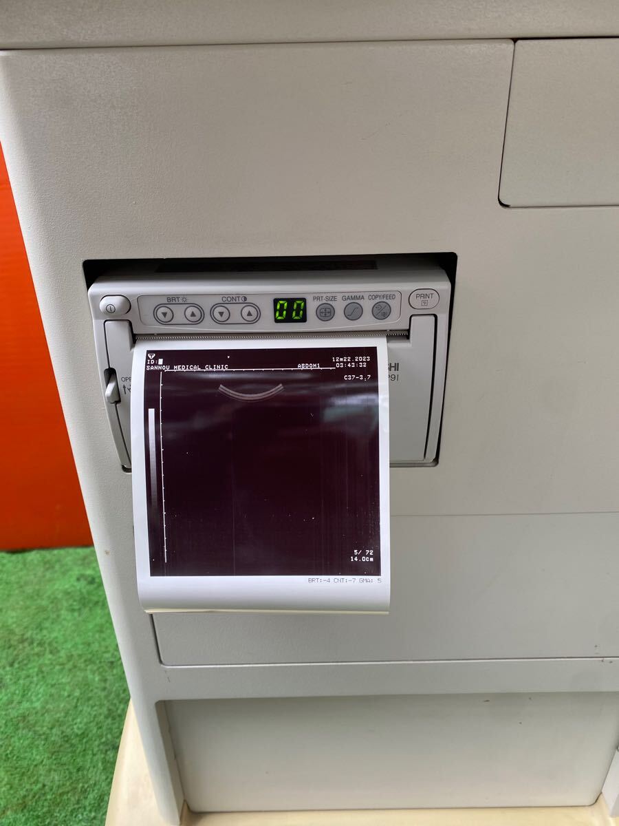 Yahoo!オークション - 東芝 TOSHIBA 【SSA-325A】 エコー診断装置 超音...
