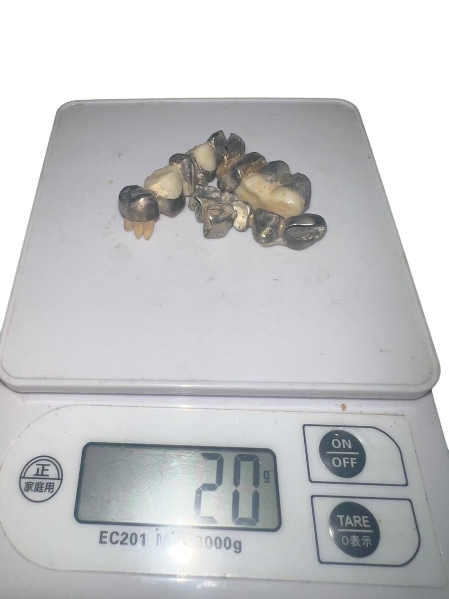 Yahoo!オークション - 歯科技工 除去冠 クラウン 87g 銀歯 材質不明